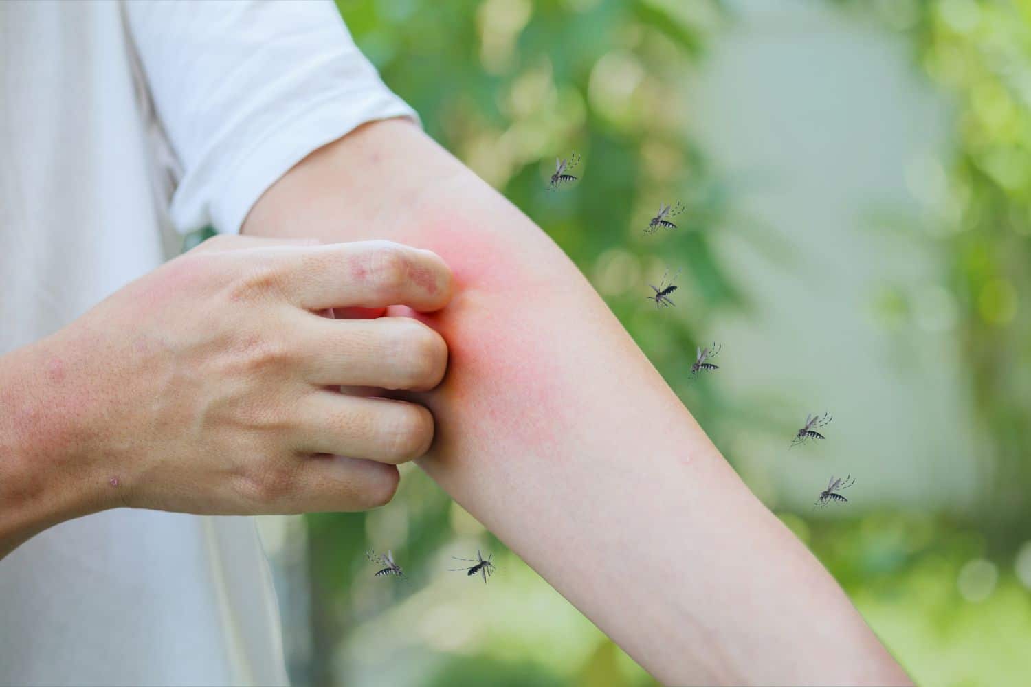 How Florida Homeowners Should Prepare for Mosquito Season | Inside ...